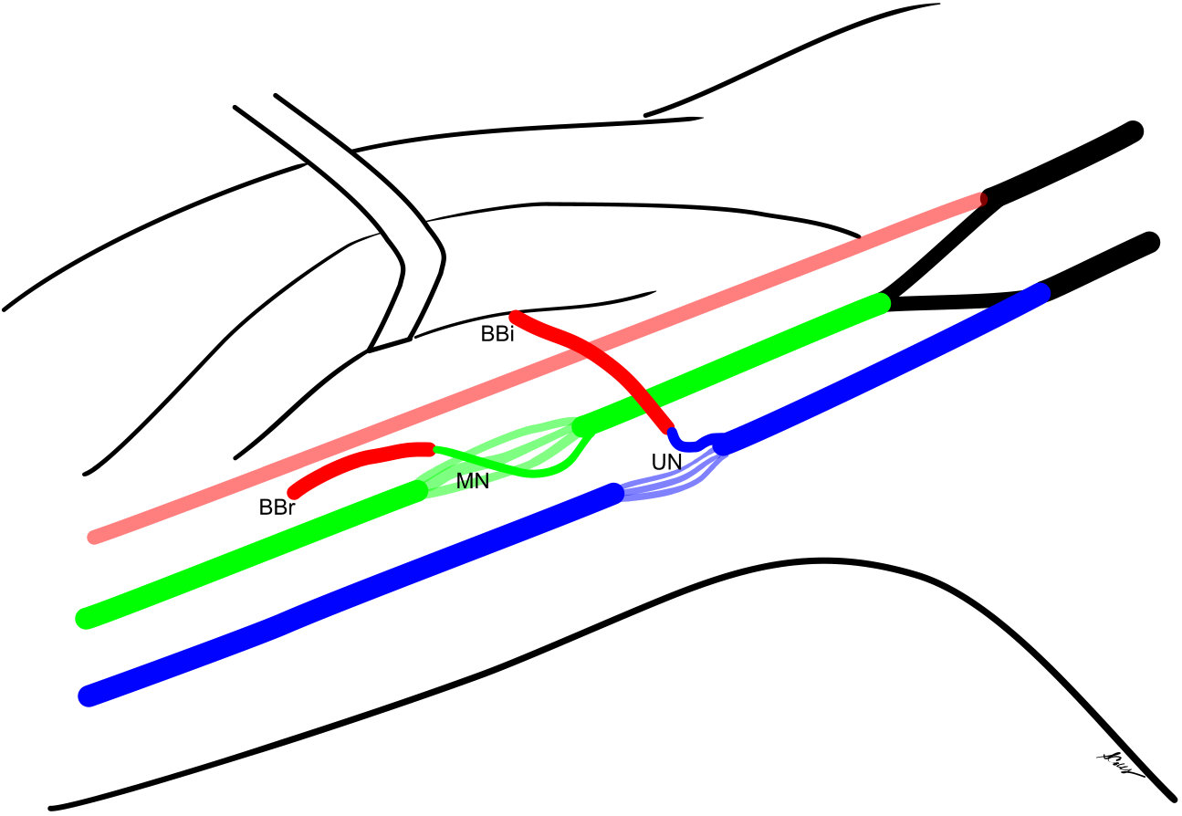 Nerve Transfer for Restoration of Elbow Flexion in Upper Brachial ...